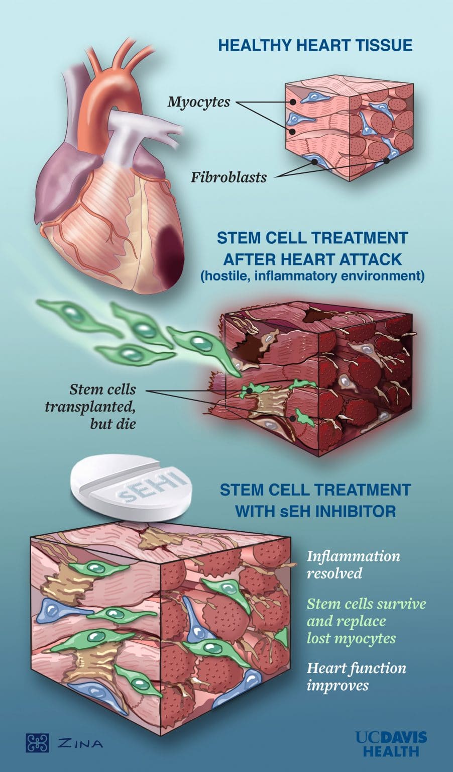 Making a way for stem cells to work for the heart – Level Five Graphics